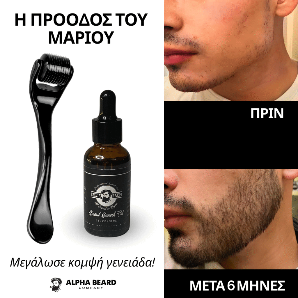 Alpha Beard Growth Oil / Minoxidil Comparison - Alpha Beard Co.